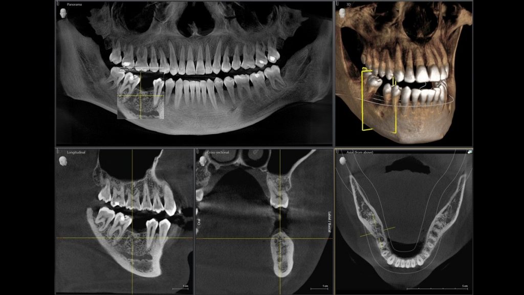 3D Xrays - Back 2 Basics Dentistry | Clarksville TN